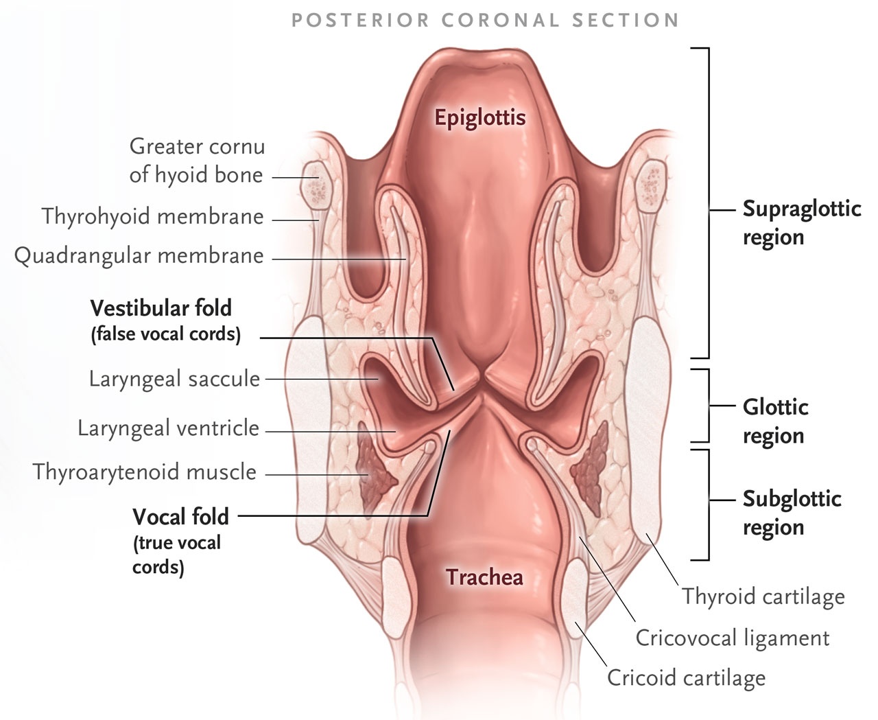 Acute Upper Airway Obstruction NEJM Resident 360 Acute Upper Airway Obstruction NEJM Resident 360
