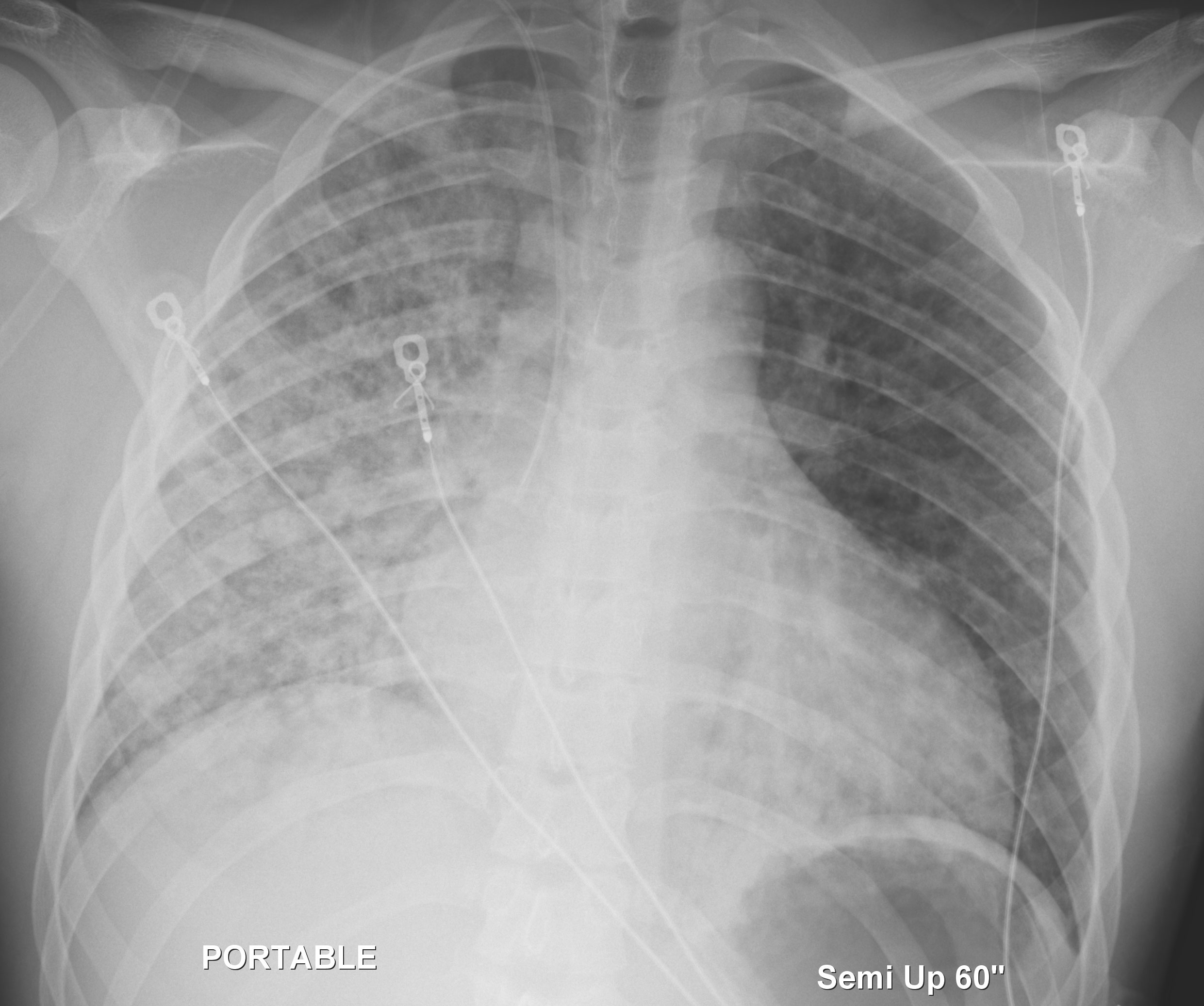 Spiraling Out Of Control NEJM Resident 360 spiraling-out-of-control-nejm-resident-360