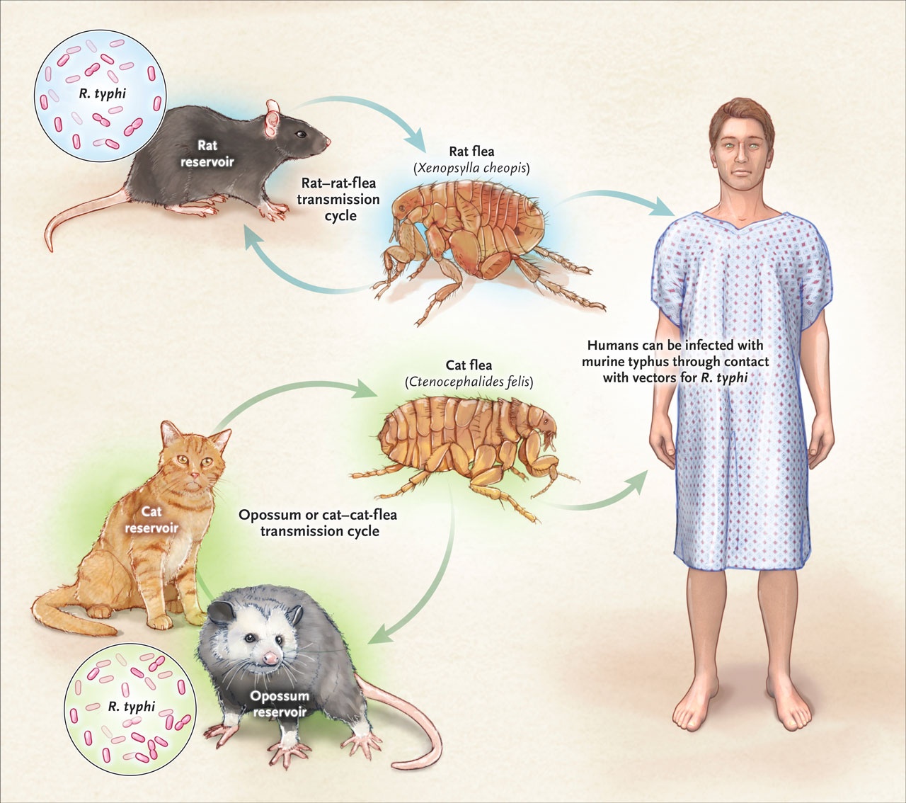 A Headache of a Diagnosis | NEJM Resident 360